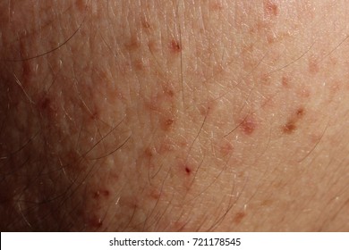 Closeup Problem Skin Wrinkles Spotted On Stock Photo 1073705483 ...