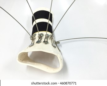 Close Spring Dynamic Splint Radial Nerve Stock Photo 460870771 ...