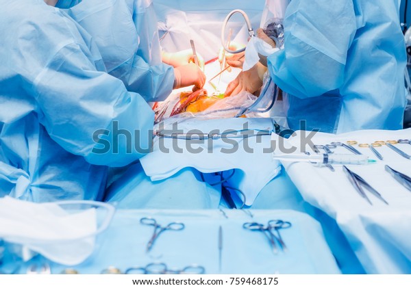 Close Surgical Operation Using Laparoscopic Equipment Stock Photo ...