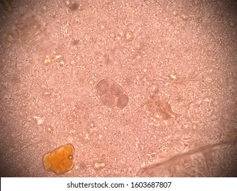 221 Parasite ova Images, Stock Photos & Vectors | Shutterstock
