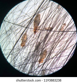 381 Lice Microscope Images, Stock Photos & Vectors | Shutterstock