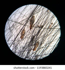 381 Lice Microscope Images, Stock Photos & Vectors | Shutterstock