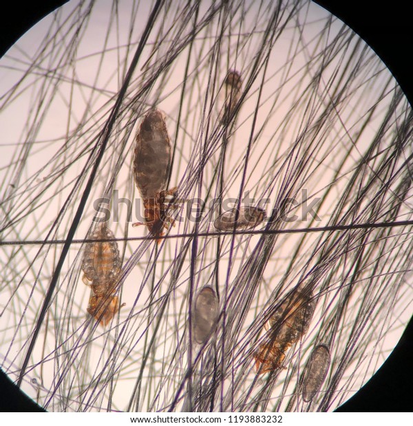 Closed Lice Egg Lice Microscope Stock Photo 1193883232 | Shutterstock