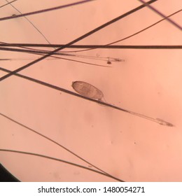 381 Lice Microscope Images, Stock Photos & Vectors | Shutterstock