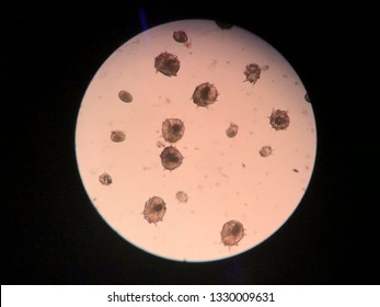 Closed Sarcoptic Mange Microscope Stock Photo 1330009631 | Shutterstock