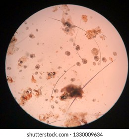 Scabies Known Sevenyear Itch Contagious Skin Foto stock 1686288217 ...