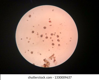 Microscope Showing Sarcoptes Mange Eggs Stock Photo 1193925004 ...