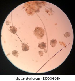 Closed Sarcoptic Mange Microscope库存照片1330009640 | Shutterstock