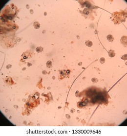 Closed Sarcoptic Mange Microscope Stock Photo 1330009646 | Shutterstock