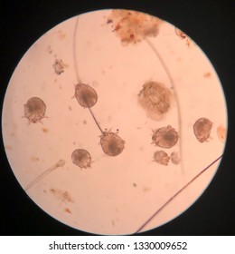 Closed Sarcoptic Mange Microscope Stock Photo 1330009652 | Shutterstock