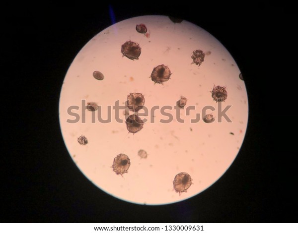 Closed Sarcoptic Mange Microscope Stock Photo 1330009631 | Shutterstock