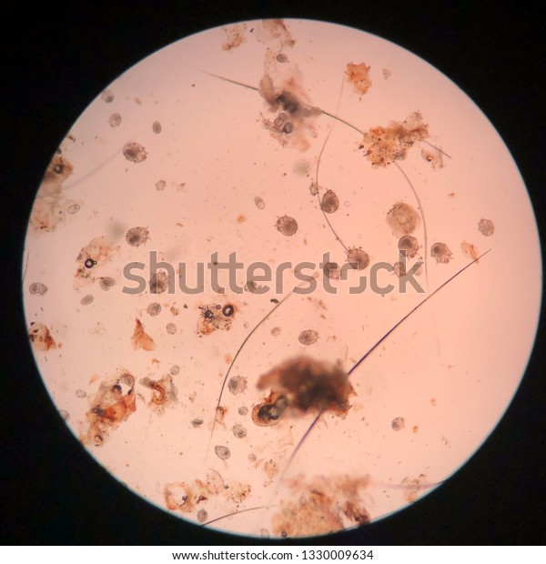 Closed Sarcoptic Mange Microscope Stock Photo (Edit Now) 1330009634