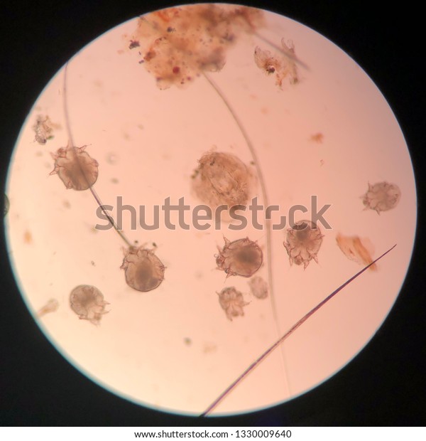 Closed Sarcoptic Mange Microscope Stock Photo 1330009640 | Shutterstock