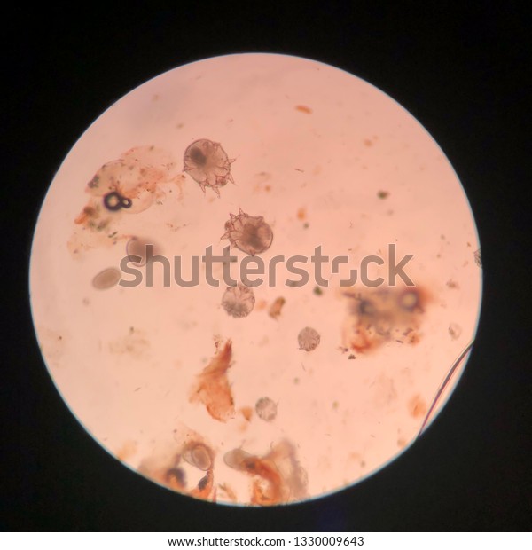 Closed Sarcoptic Mange Microscope Stock Photo 1330009643 | Shutterstock