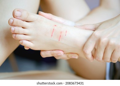 2,309 Bleeding foot Images, Stock Photos & Vectors | Shutterstock