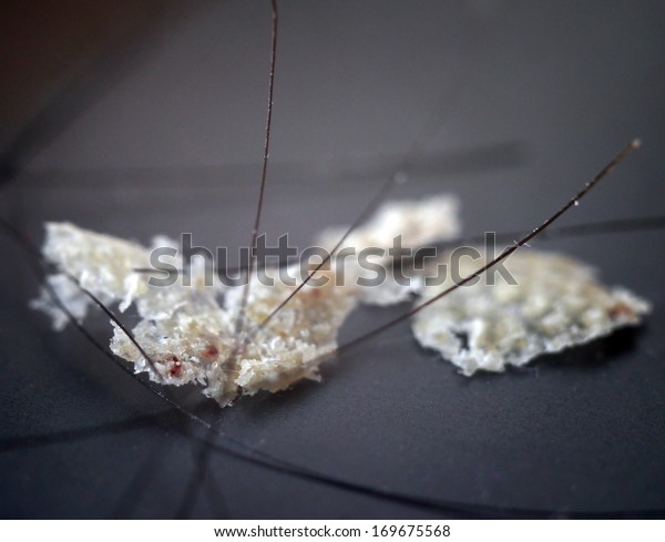 Closeup Dandruff Stock Photo (Edit Now) 169675568