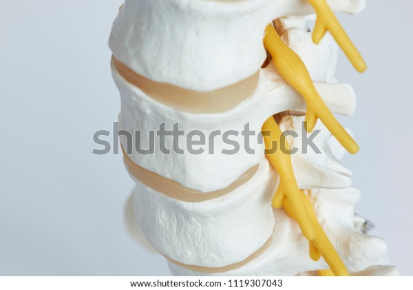 Closeup View Nerve Root Exiting Intervertebral Stock Photo 1119307043 ...