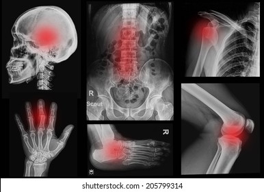 637 imágenes de X ray collage - Imágenes, fotos y vectores de stock ...