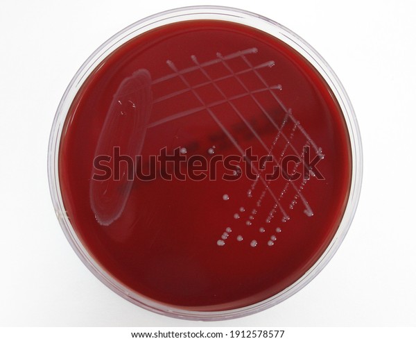 Morfología de colonias de Enterococcus faecalis Foto de stock ...