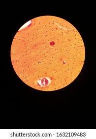 Compact Bone Structure Under Microscope Stock Photo 1632105301 ...