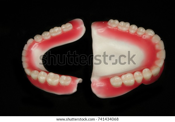 Complete Denture Side View Isolate Black Stock Photo 741434068 ...