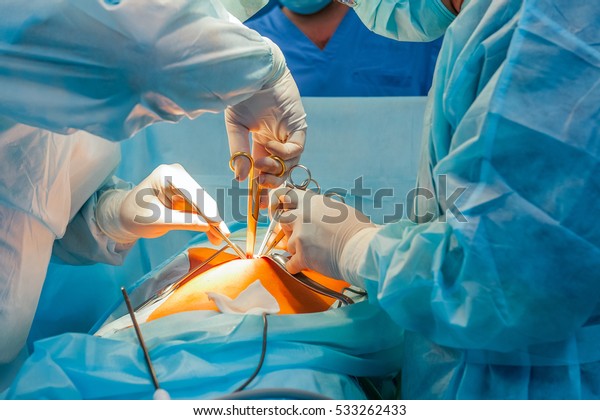 Complex Laparoscopic Operation On Peritoneal Cavity Stock Photo ...