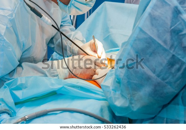 Complex Laparoscopic Operation On Peritoneal Cavity Stock Photo (Edit ...