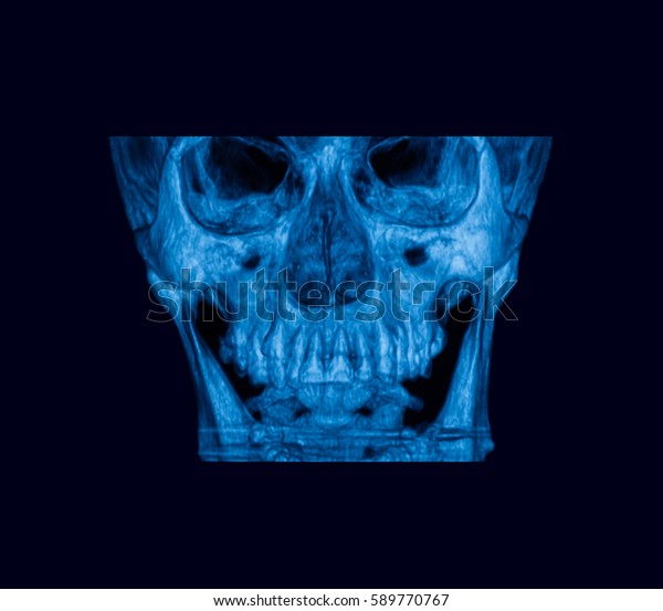 Computed Tomography 3d Ct Scan Dental Stock Photo (Edit Now) 589770767