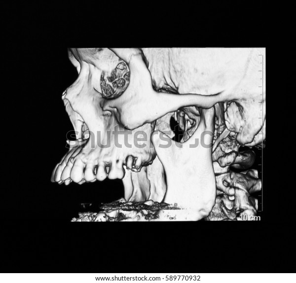 Computed Tomography 3d Ct Scan Dental Stock Photo (Edit Now) 589770932