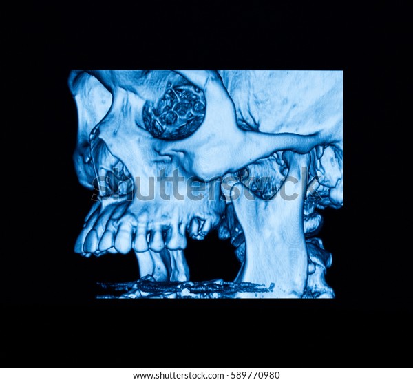 Computed Tomography 3d Ct Scan Dental Stock Photo 589770980 | Shutterstock
