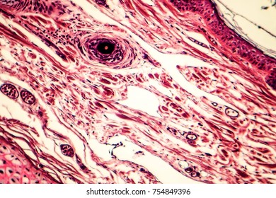 Connective Tissue Located Human Outer Ear Stock Photo 754849396 ...
