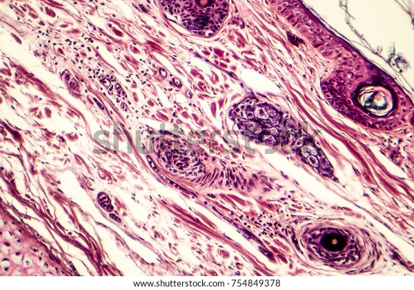 Connective Tissue Located Human Outer Ear Stock Photo (Edit Now) 754849378