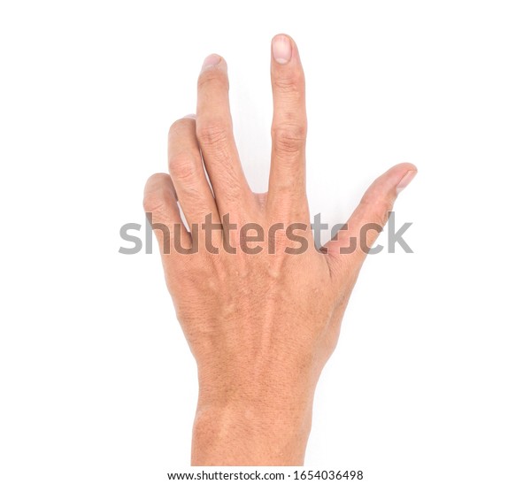 Contracture Left Hand Asian Young Man Stock Photo (Edit Now) 1654036498