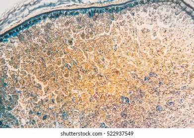 Corn Seed Longitudinal Section Endosperm Flowering Stock Photo (Edit ...