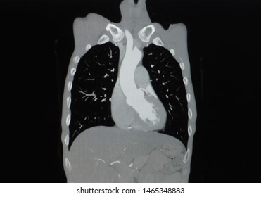 550 Normal ct scan Images, Stock Photos & Vectors | Shutterstock