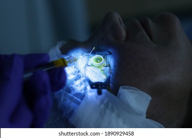 Cross Linking Process During Eye Treatment Stock Photo 1890929458 ...