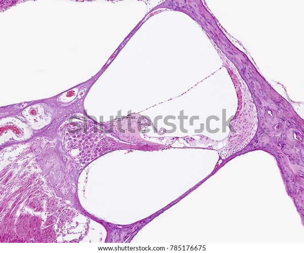 Cross Section Cochlea Cochlear Duct Shows Stockfoto 785176675 ...
