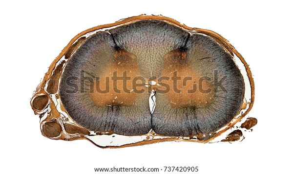 Cross Section Cut Spinal Under Microscope Foto stock 737420905 ...