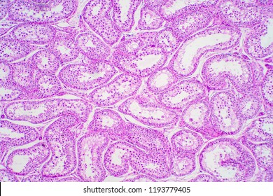 Cross Section Human Testis Under Microscope Stock Photo (Edit Now ...