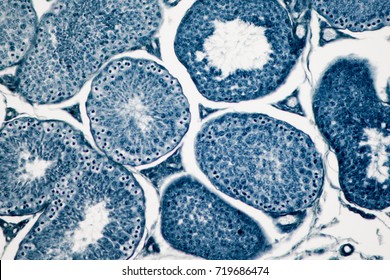 Cross Section Human Testis Under Microscope Foto stock 719686474 ...