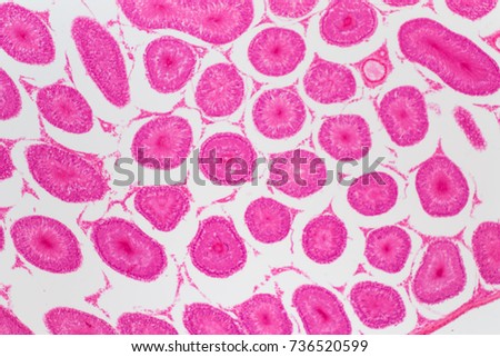 Cross Section Human Testis Under Microscope Stock Photo (Edit Now ...