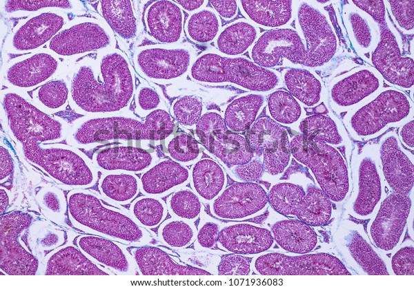 Cross Section Human Testis Under Microscope Stock Photo 1071936083 ...