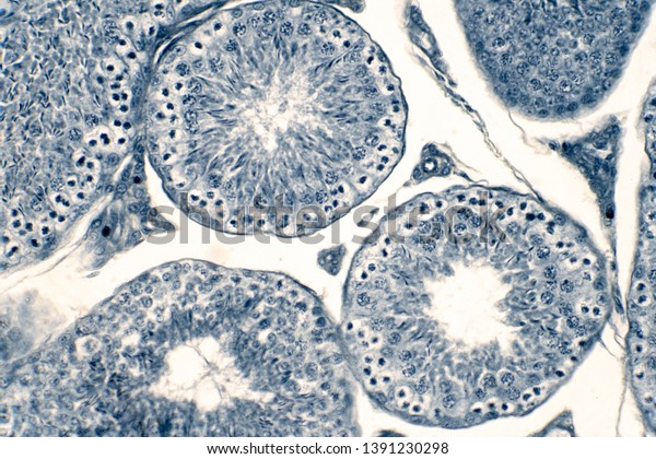 Cross Section Human Testis Under Microscope Stock Photo 1391230298 ...