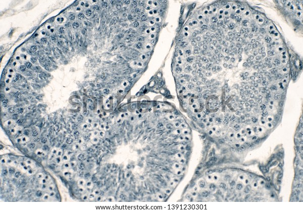 Cross Section Human Testis Under Microscope Stock Photo (Edit Now ...