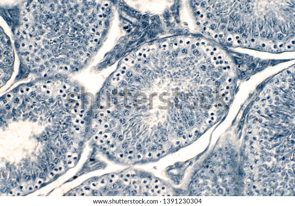 Cross Section Human Testis Under Microscope Stock Photo 1391230304 ...