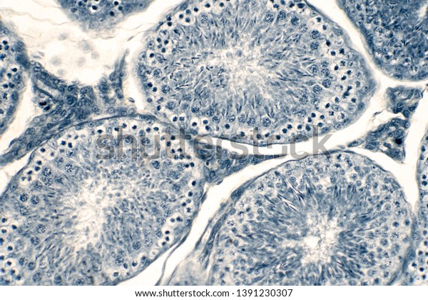 Cross Section Human Testis Under Microscope Stock Photo 1391230307 ...
