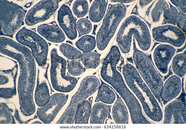 Cross Section Human Testis Under Microscope Stock Photo 634258616 ...