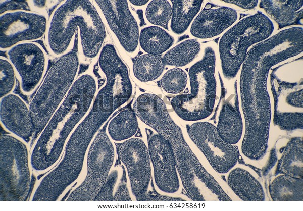 Cross Section Human Testis Under Microscope Stock Photo 634258619 ...