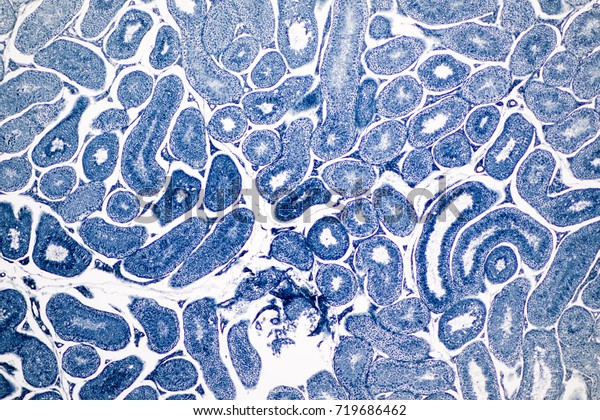 Cross Section Human Testis Under Microscope Stock Photo 719686462 ...
