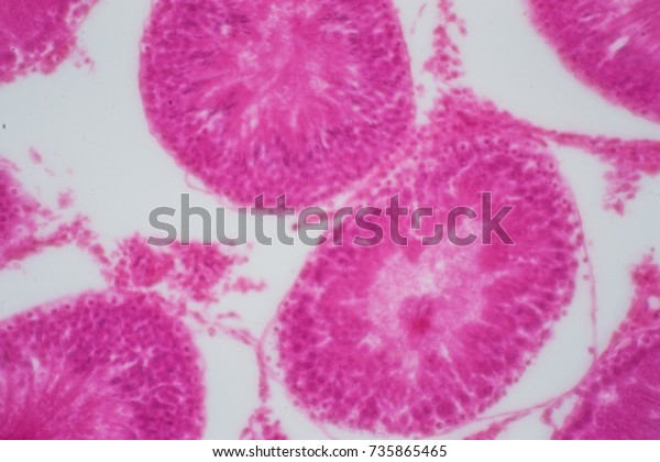 Cross Section Human Testis Under Microscope Stock Photo (Edit Now ...